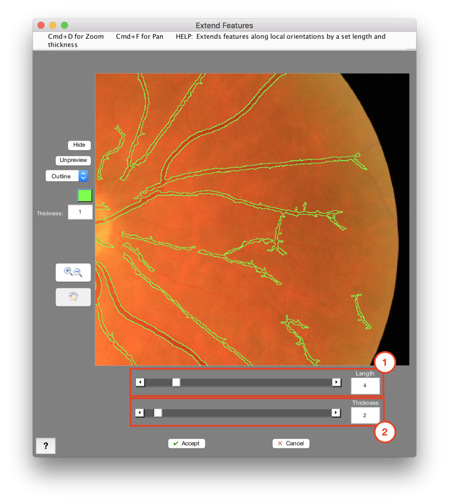Extend Features - MIPAR User Manual - v5.3